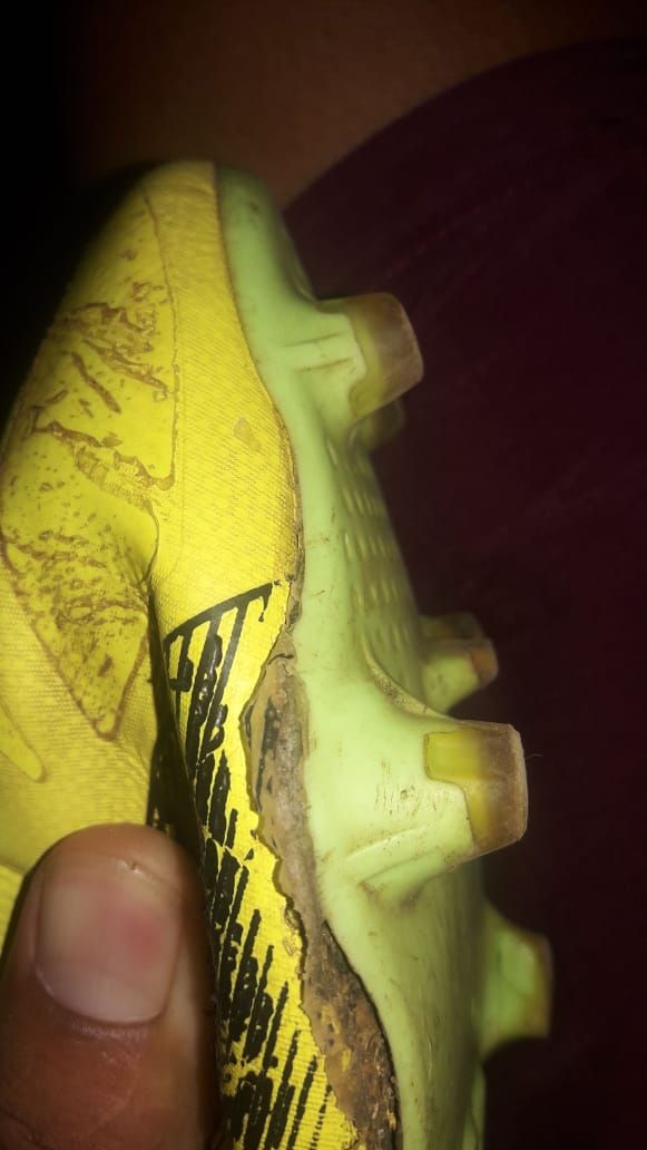 Copa Paraguay: “Jugó con los botines rotos” - Fútbol - ABC Color