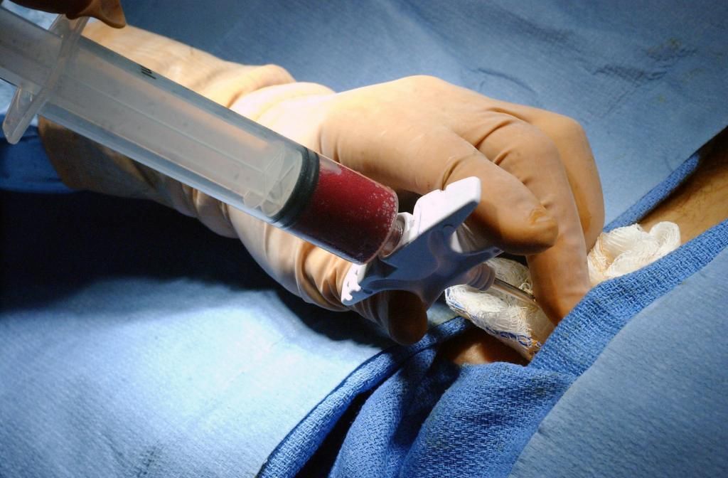 Aprueban Medicamento Contra El Cáncer De Médula ósea Ciencia Abc Color