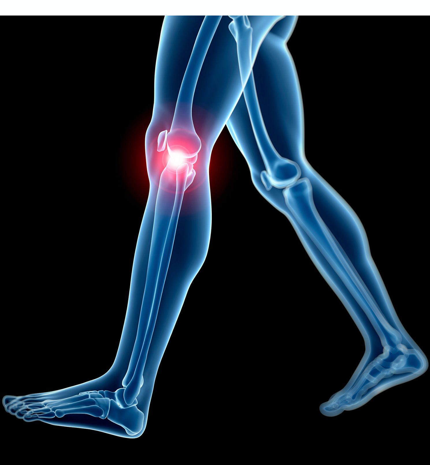 Cirugía de rodilla - Salud - ABC Color