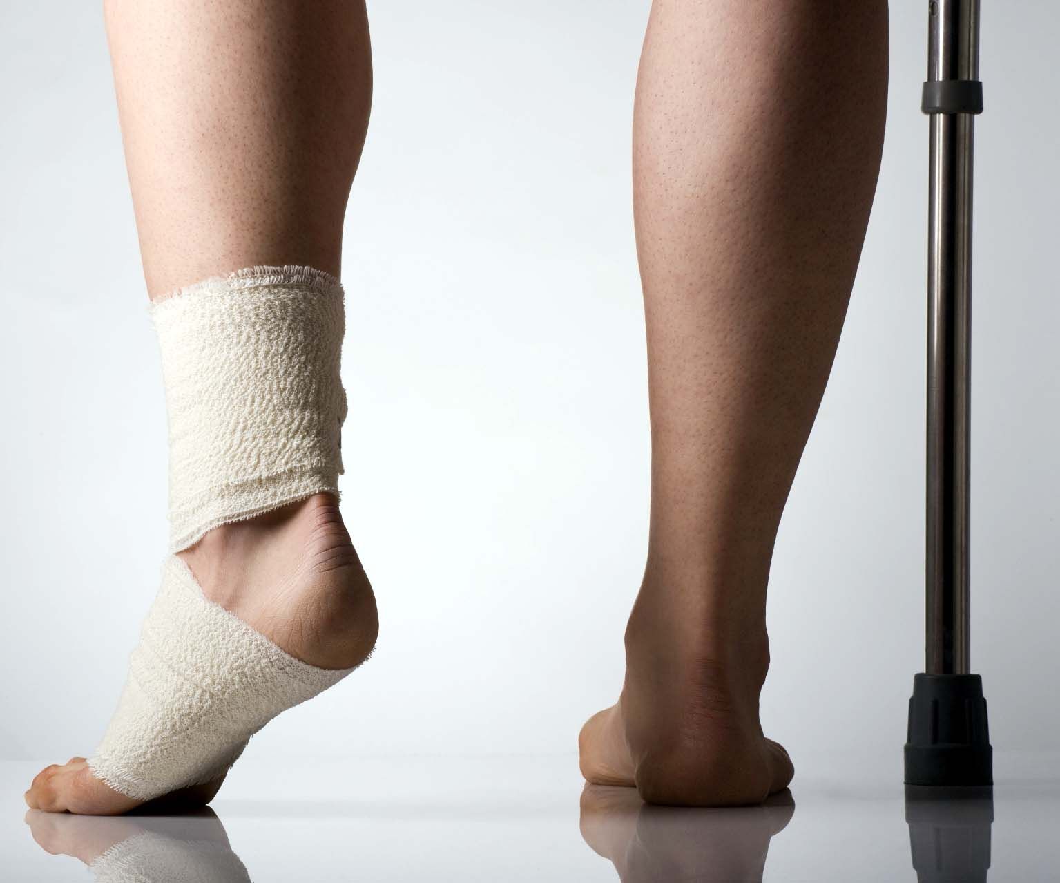 Torceduras en el tobillo - Salud - ABC Color