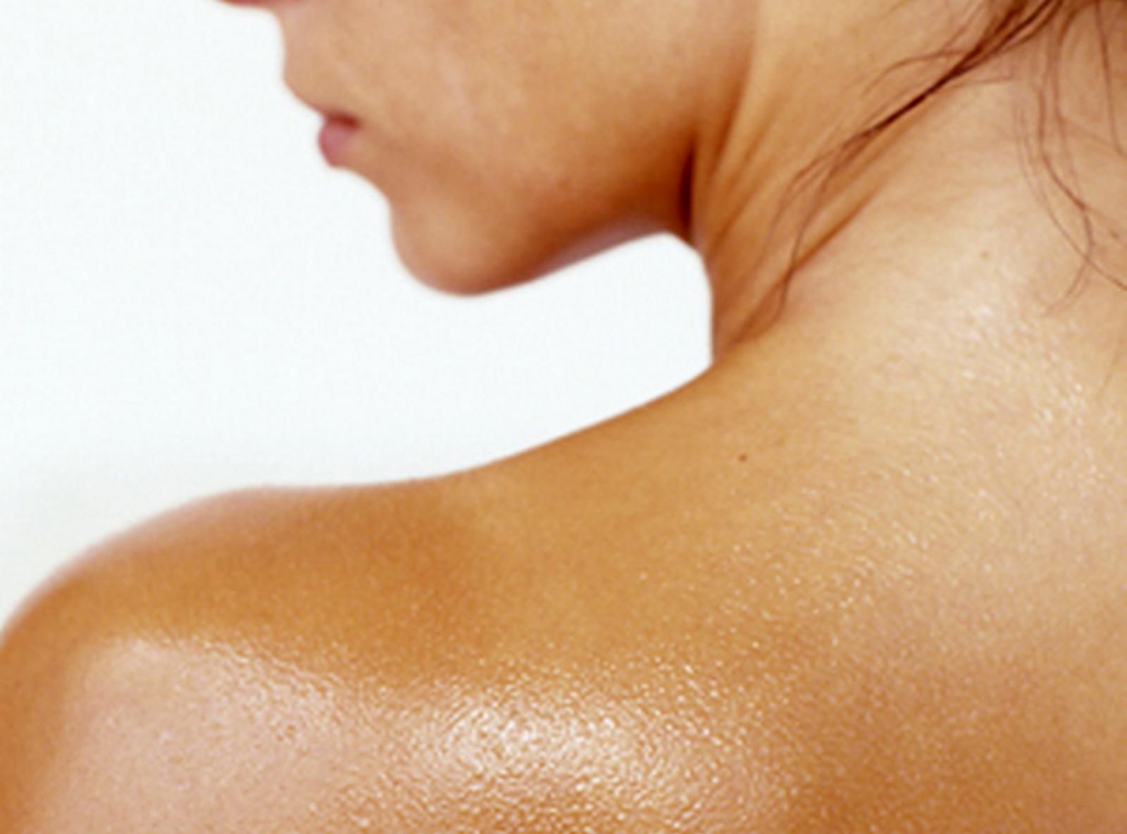 Vitiligo una enfermedad multifactorial - Salud - ABC Color
