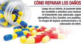 La lesión cardíaca - Salud - ABC Color