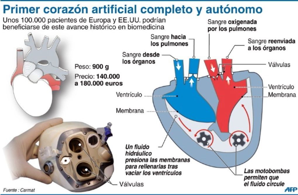 El primer corazón artificial es una esperanza para enfermos ...