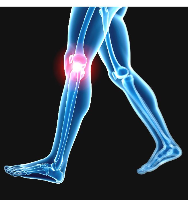 Desbalance muscular - Salud - ABC Color