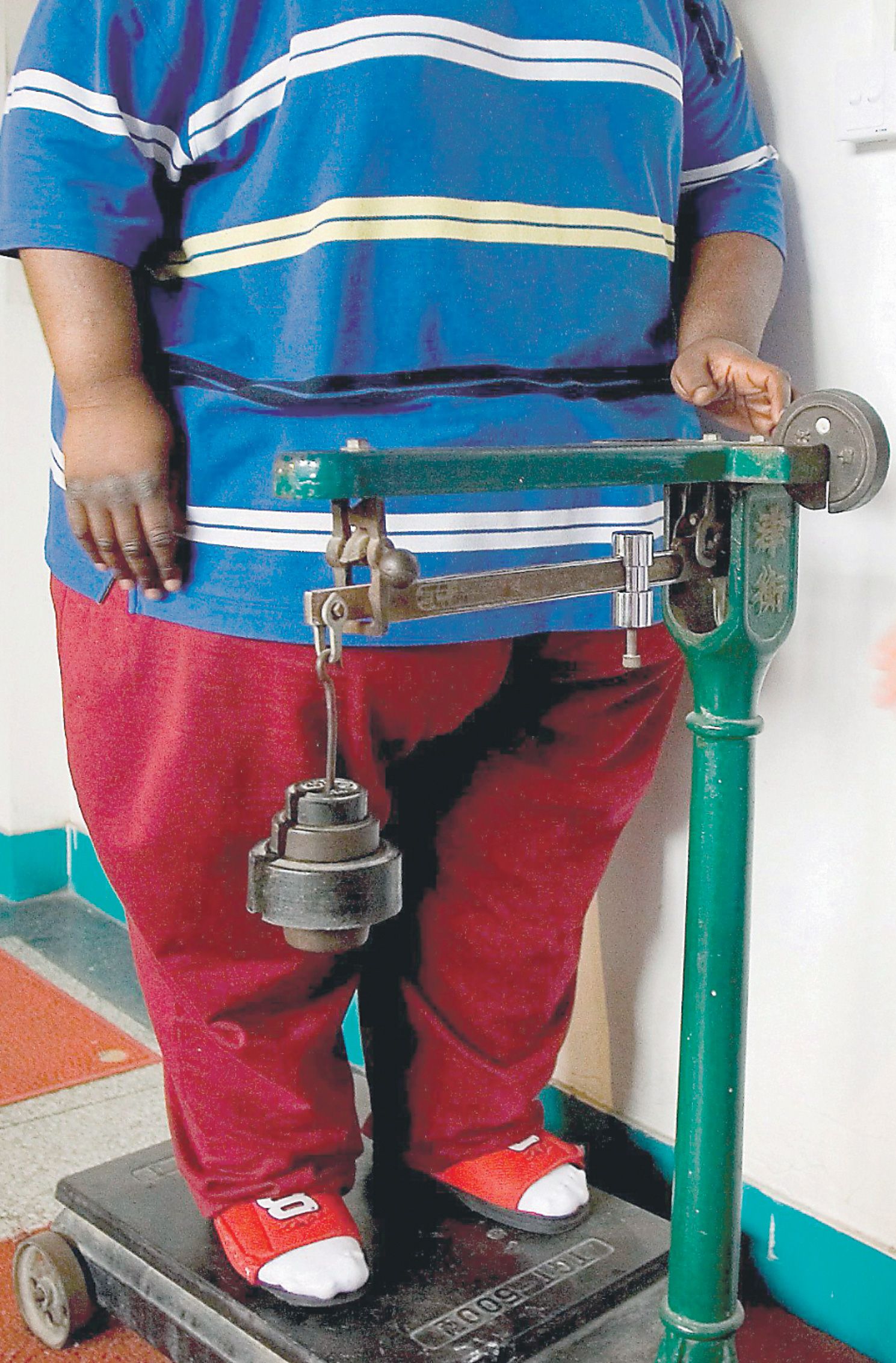 Obesidad en adolescentes - Salud - ABC Color